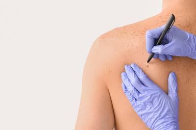 SKIN CHECKS AND PROCEDURES